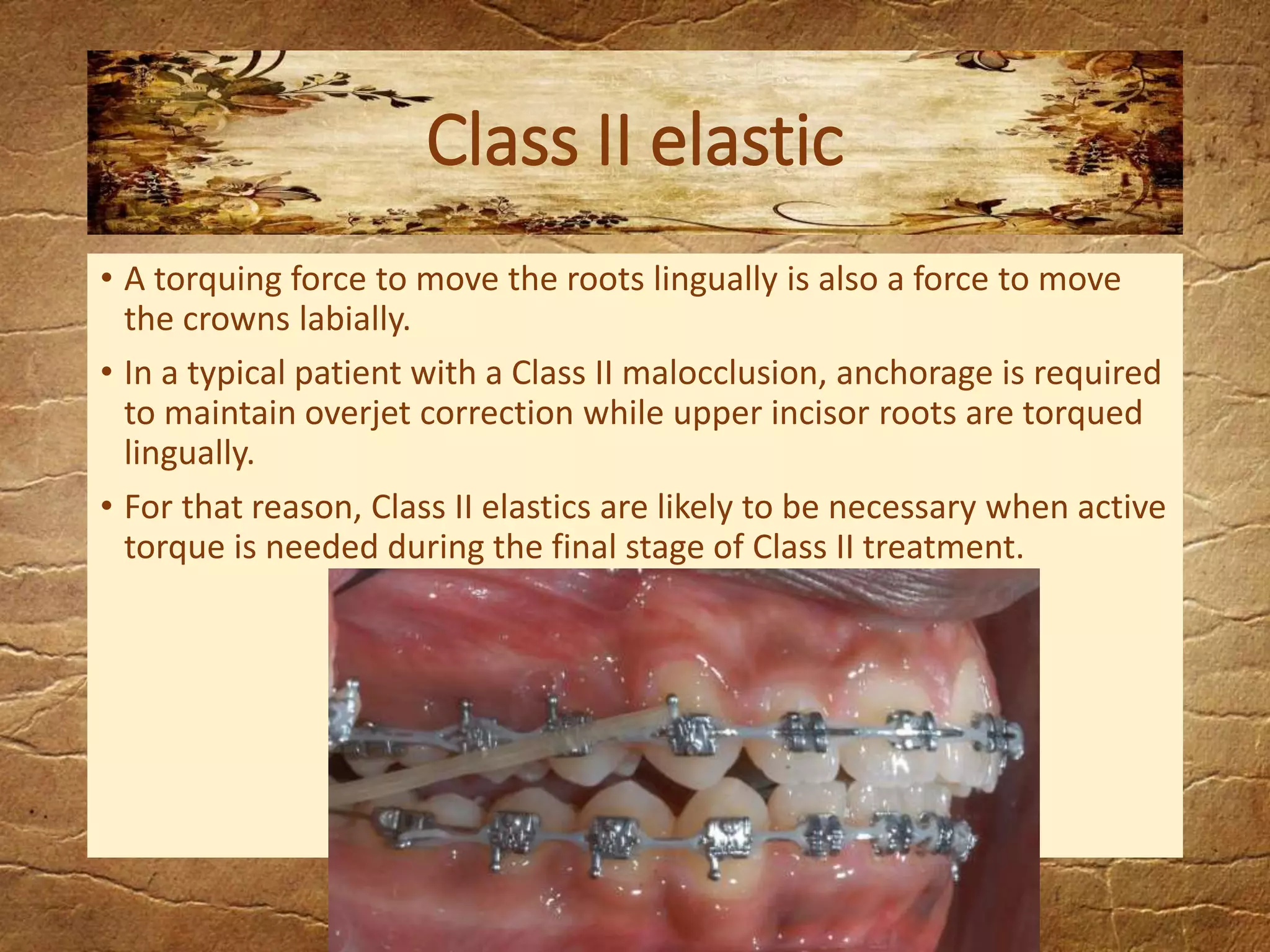 comprehensive orthodonic treatment | PPTX