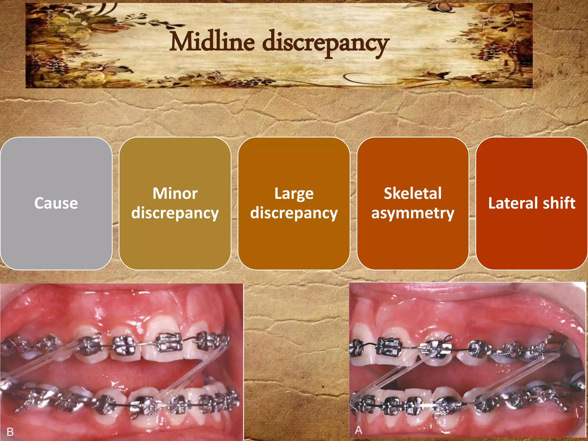 comprehensive orthodonic treatment | PPTX