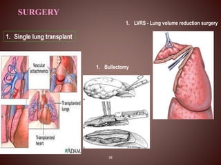 Chronic Obstructive pulmonary diasese | PPTX