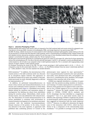 CNNM4(2009) | PDF | Eye and Vision Conditions | Diseases and Conditions