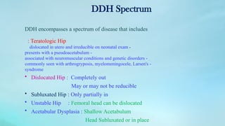 DDH developmental dysplasia of hip .pptx
