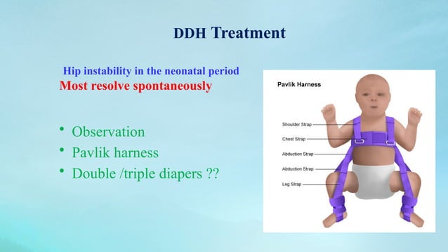 DDH developmental dysplasia of hip .pptx