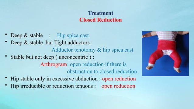 DDH developmental dysplasia of hip .pptx