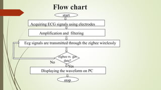 ECG Transmission | PPT