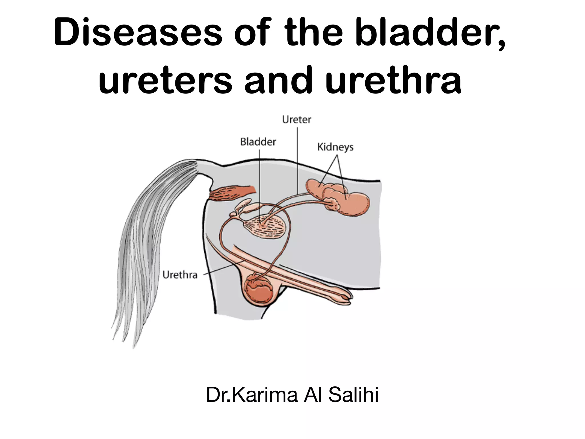 9 diseases of the bladder, ureters and urethra | PDF