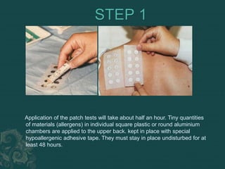 9 Eczematous Dermatitis--CD.pptx awesome | PPT