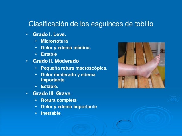 9 esguince del tobillo