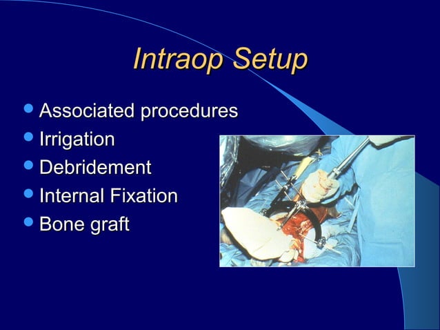 (9)external fixation indications and techniques(bonatus) | PPT | First ...