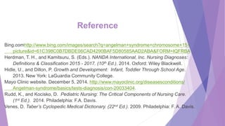 ANGELMAN SYNDROME | PPT