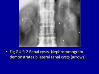 9 focal renal mass | PPT