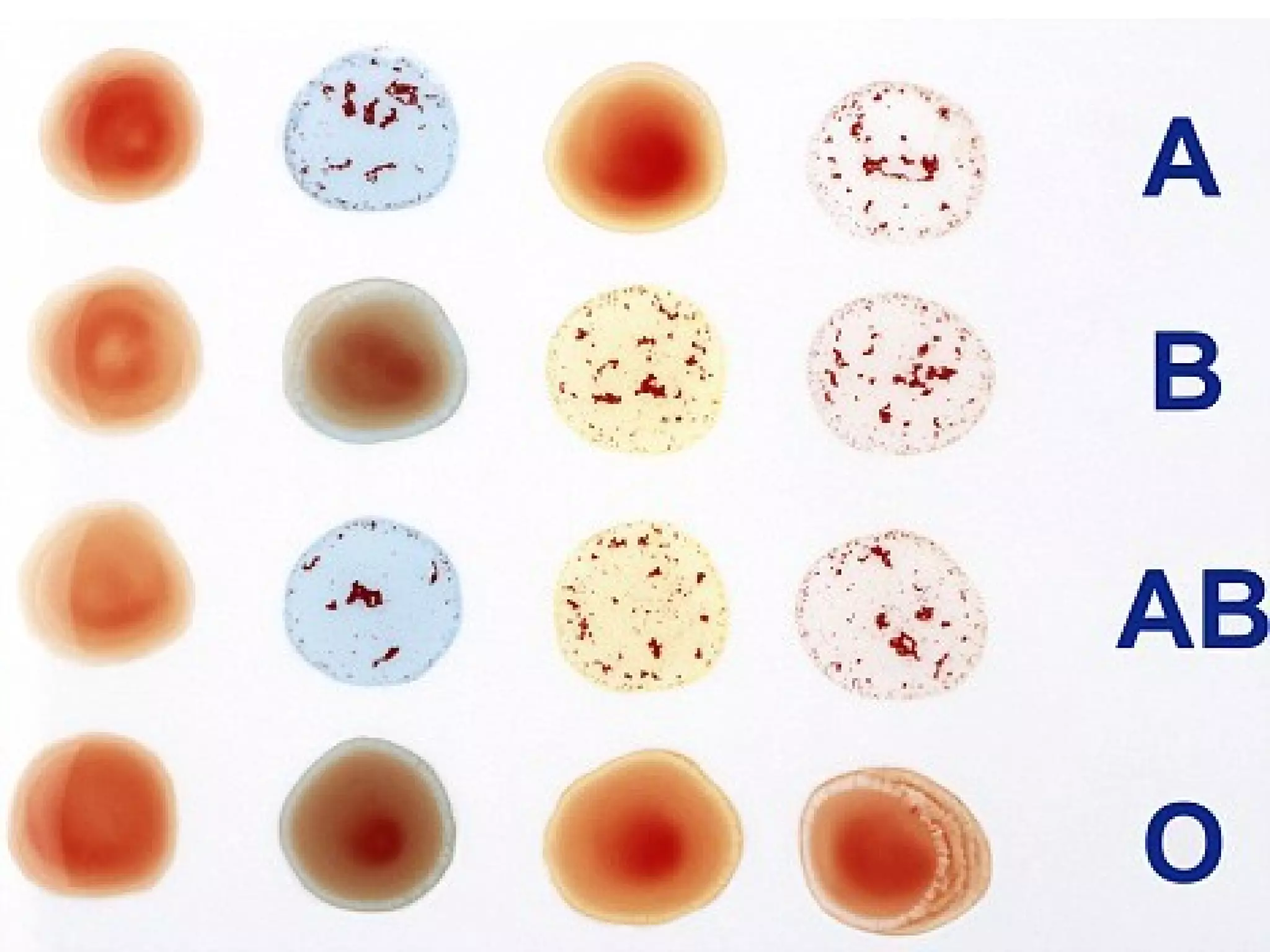 Forensic Serology | PPT