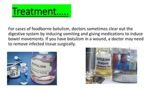 BOTULISM | PPTX | Infectious Diseases | Diseases and Conditions