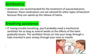 BOTULISM | PPTX