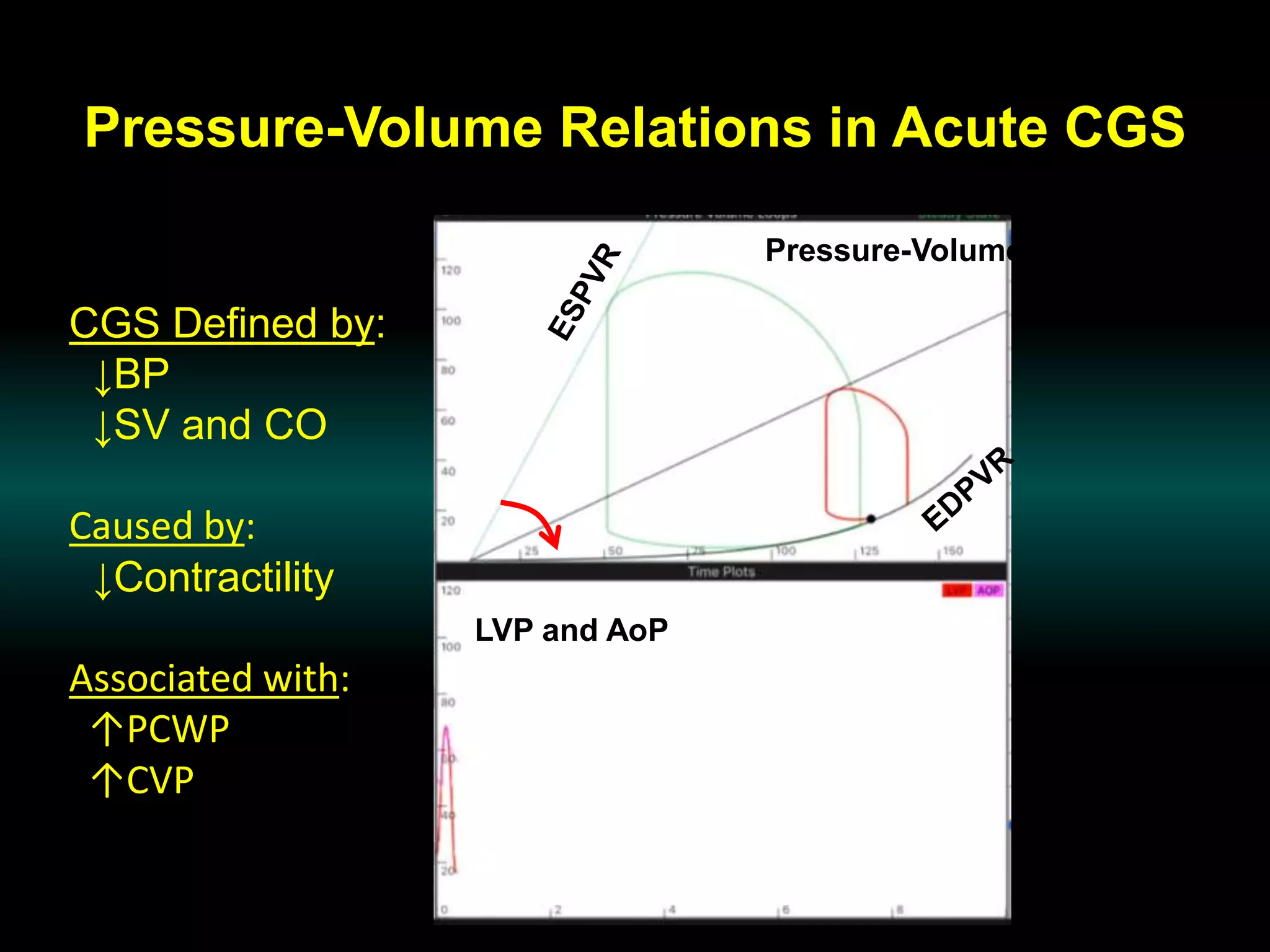 PCI & AimRadial 2018 | Treating Cardiogenic Shock with Impella with ...