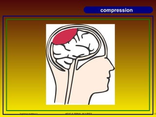 Head and spinal injuries | PPT
