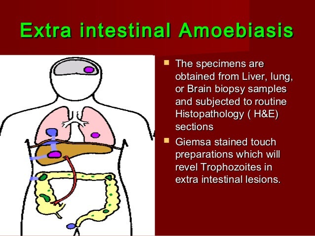 Amoebiasis 090528093701-phpapp01