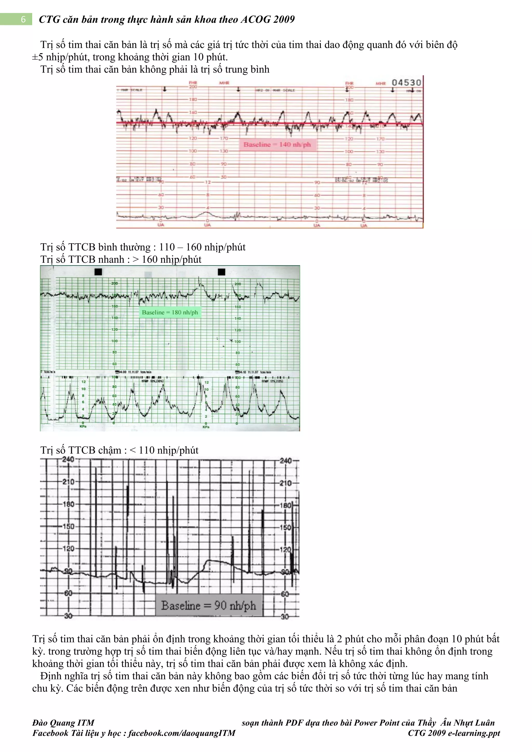 CTG CĂN BẢN TRONG THỰC HÀNH SẢN KHOA ACOG 2009 | PDF