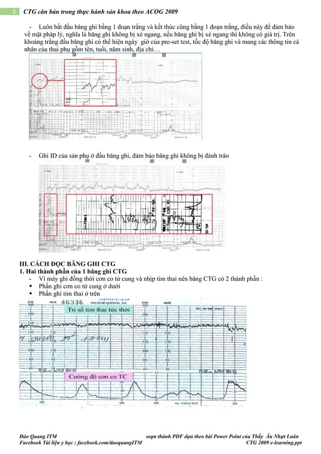 CTG CĂN BẢN TRONG THỰC HÀNH SẢN KHOA ACOG 2009 | PDF