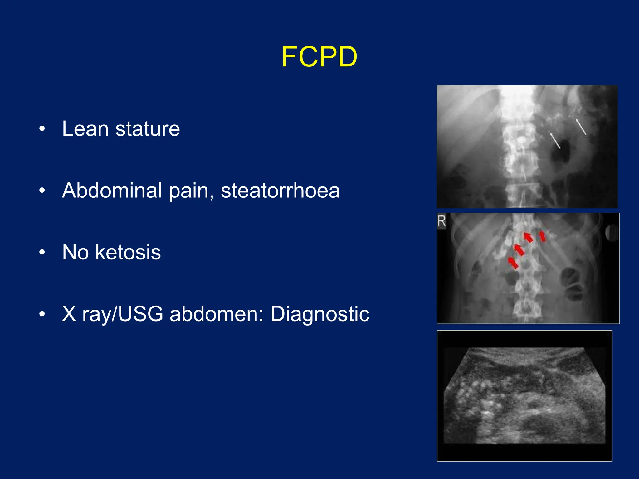 9 LATENT Autoimmune Diabetes in Adults (LADA) Current Status.ppt