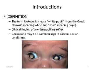 9 pediatric opththalmology leukocoria tt.pptx