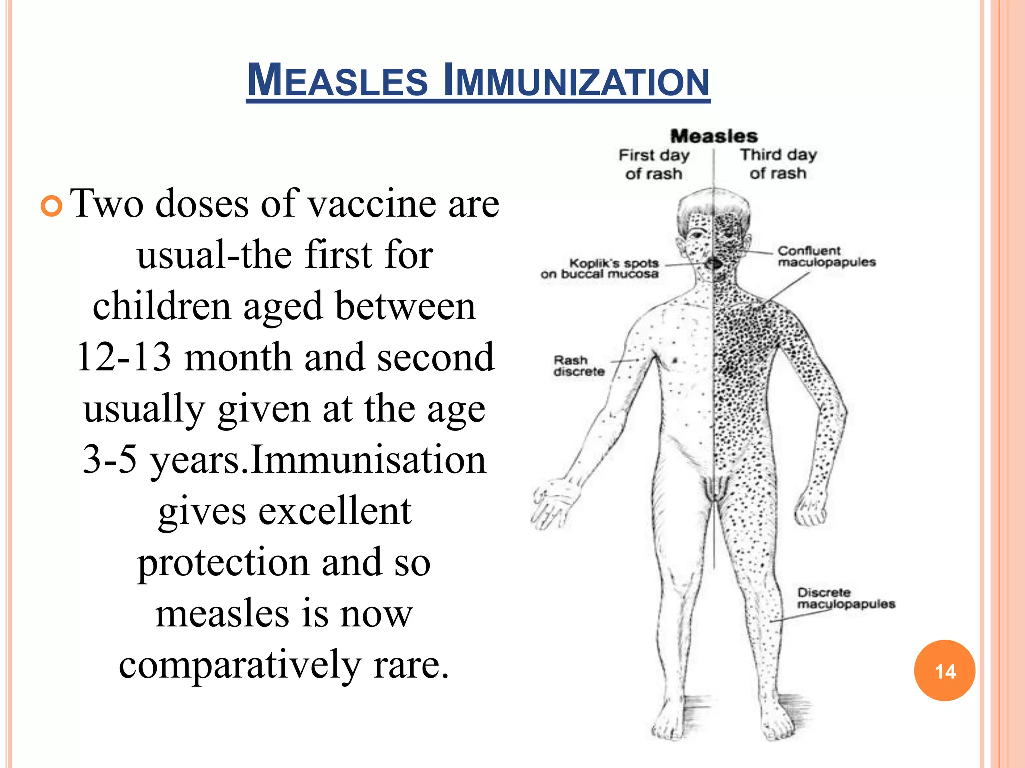 Measles | PPTX