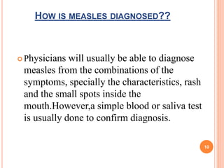 Measles | PPTX