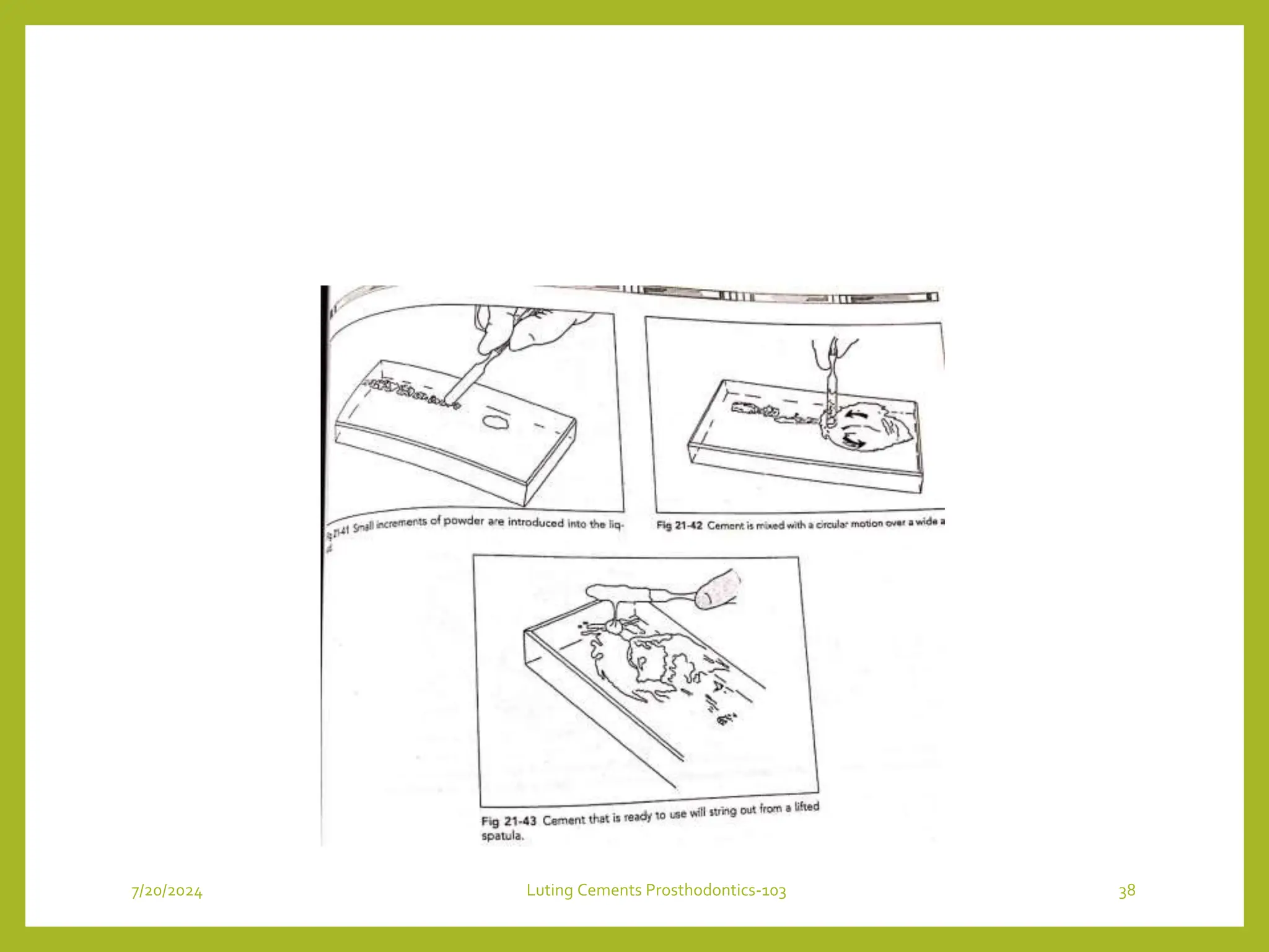 Luting agents in prosthodontics and their effects | PPTX