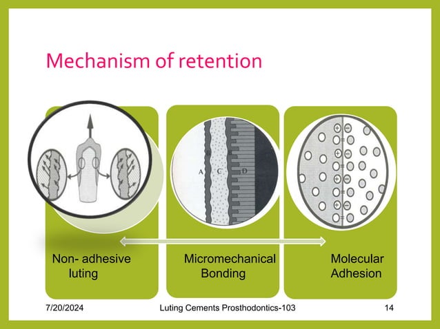 Luting agents in prosthodontics and their effects | PPTX