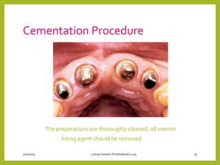 Luting agents in prosthodontics and their effects | PPTX
