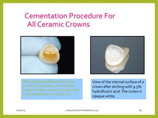 Luting agents in prosthodontics and their effects | PPTX