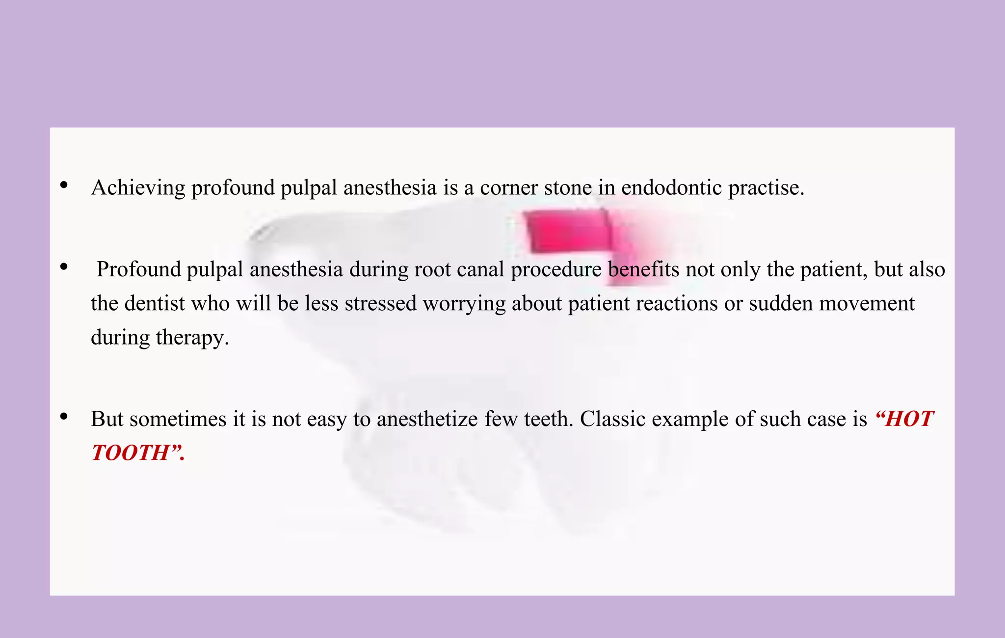 Mangement of endodontic pain | PPTX