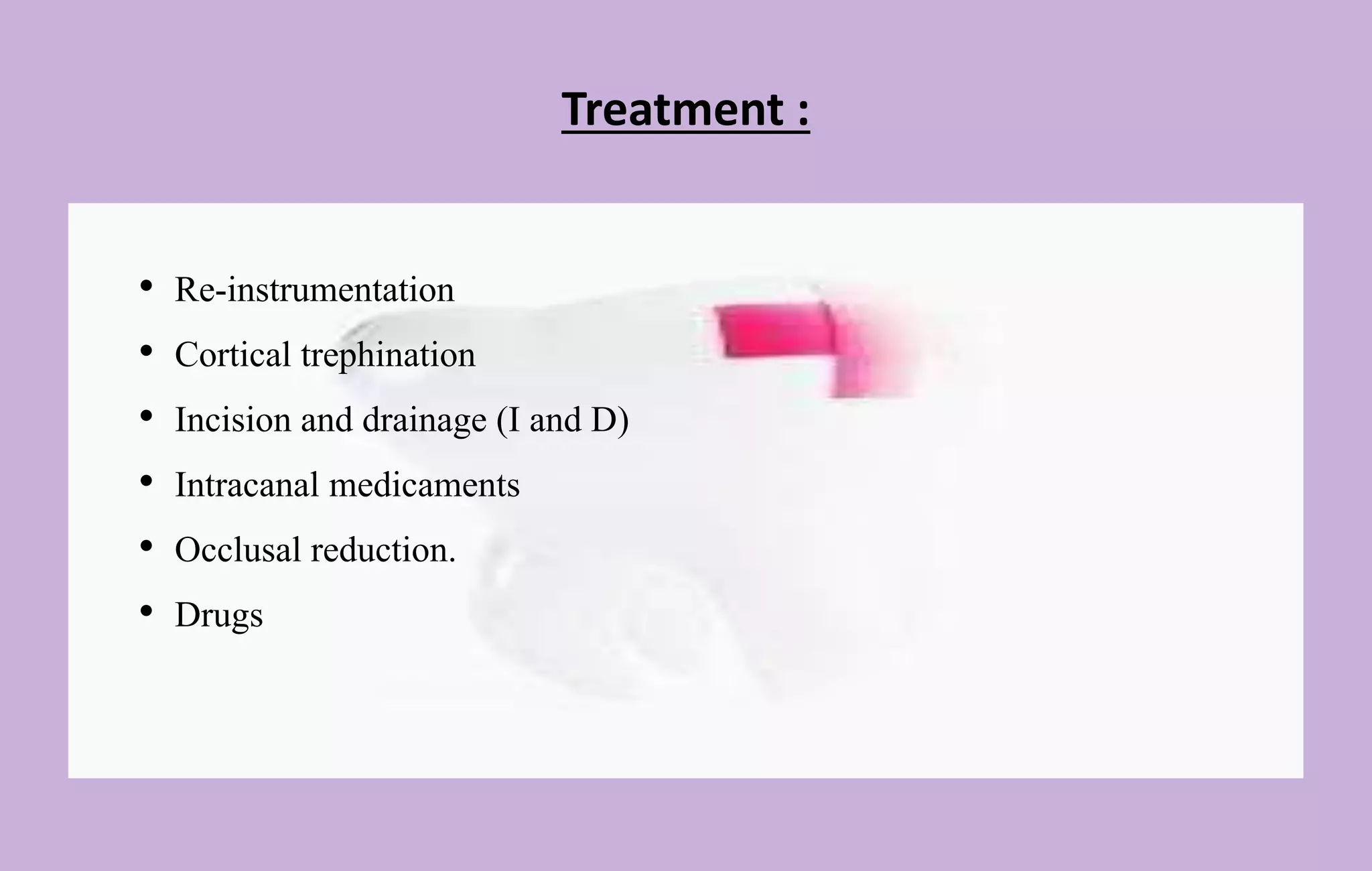 Mangement of endodontic pain | PPTX