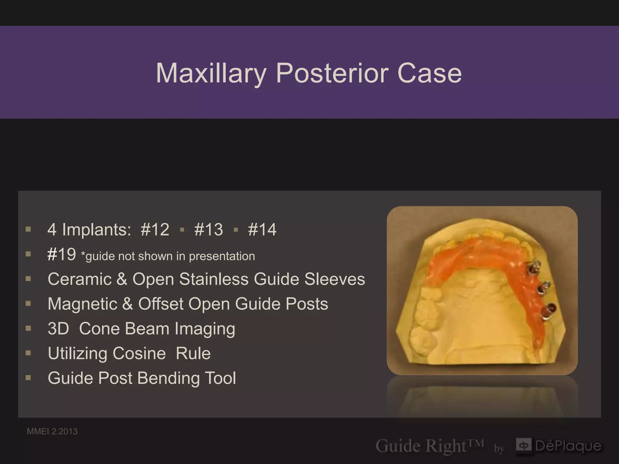 9 maxillary posterior case | PPT
