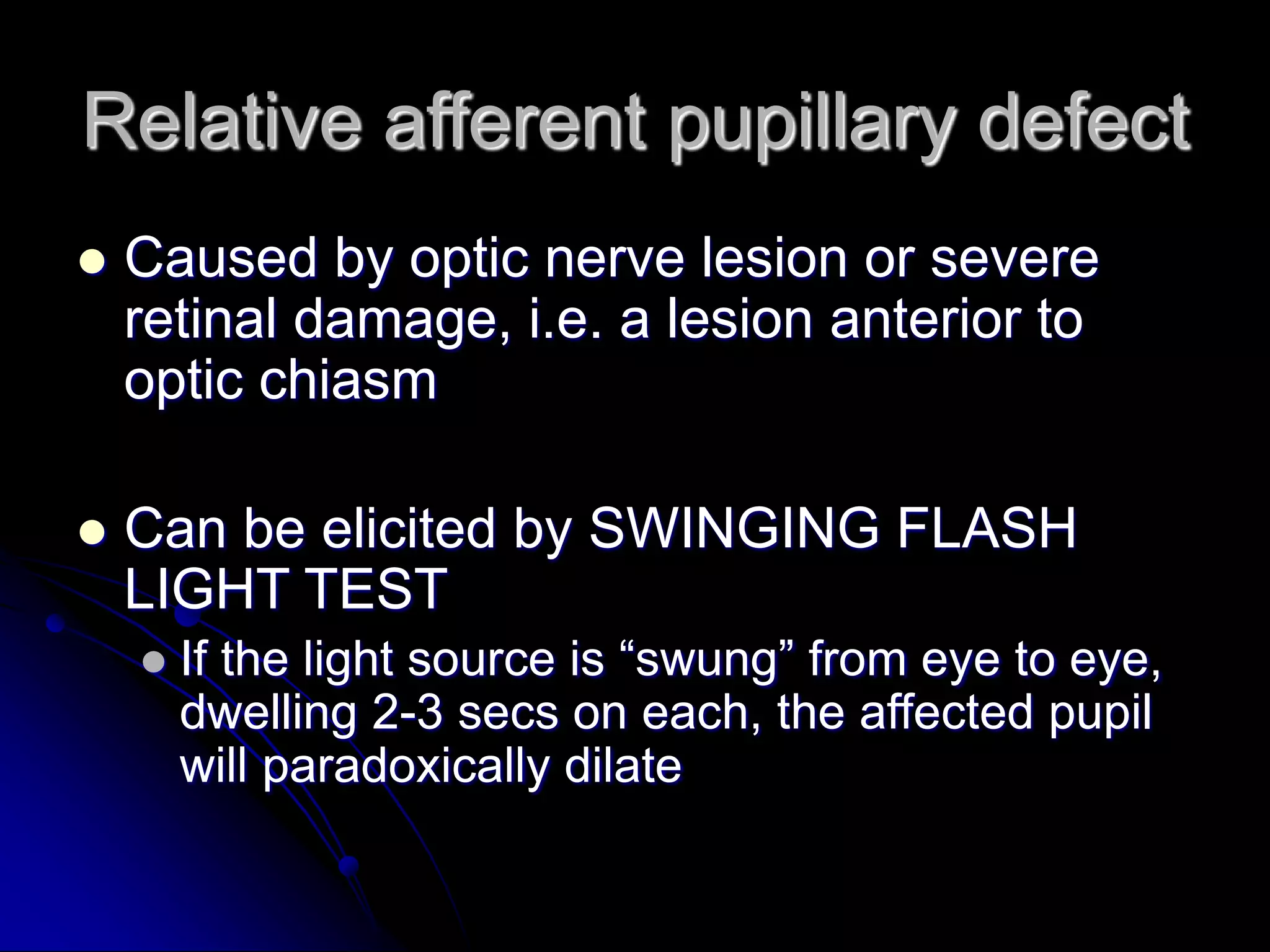 Neuro ophthalmology RCSI | PPT