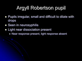 Neuro ophthalmology RCSI | PPT