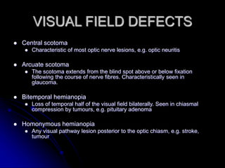 Neuro ophthalmology RCSI | PPT
