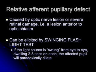 Neuro ophthalmology RCSI | PPT