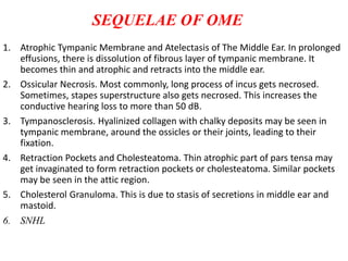 NONSUPPURATIVE OTITIS MEDIA | PPTX