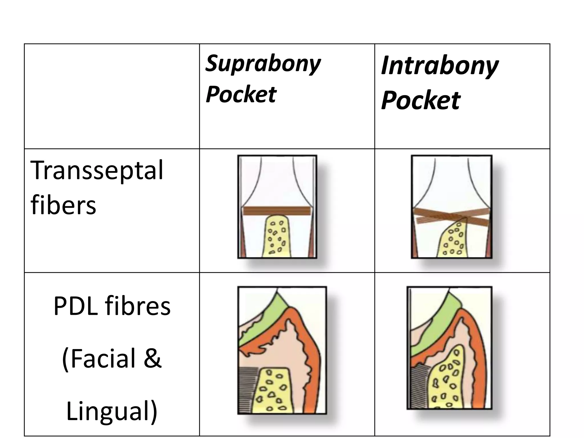Periodontal pocket | PPTX