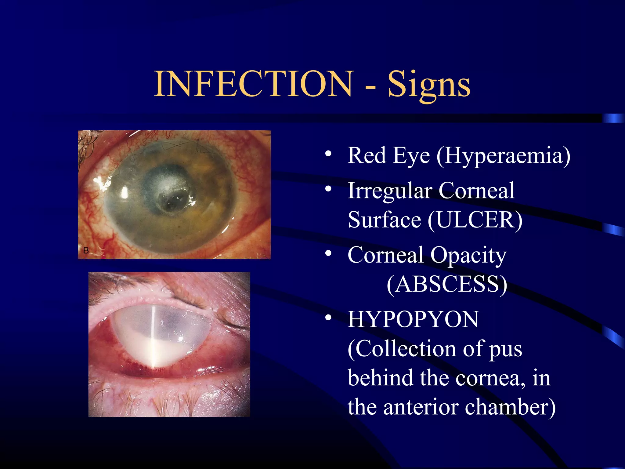 Ocular emergencies | PPT