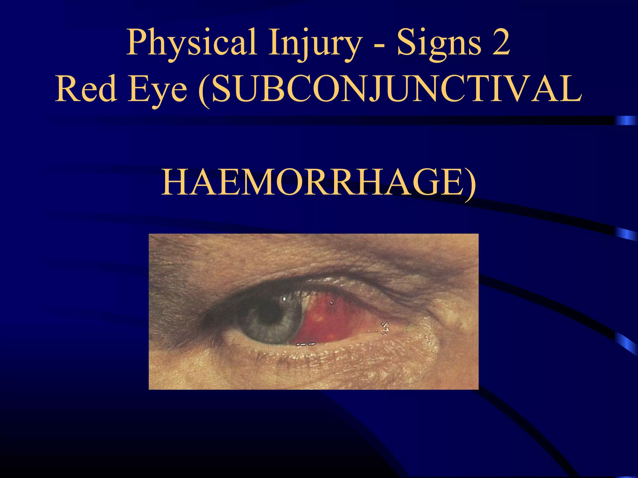 Ocular emergencies | PPT