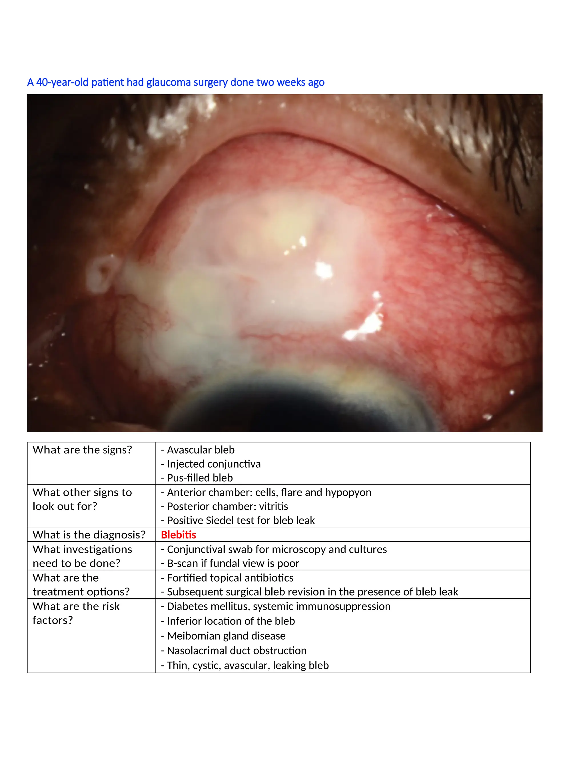 9 Objective Structured Clinical Examination in Glaucoma | DOCX