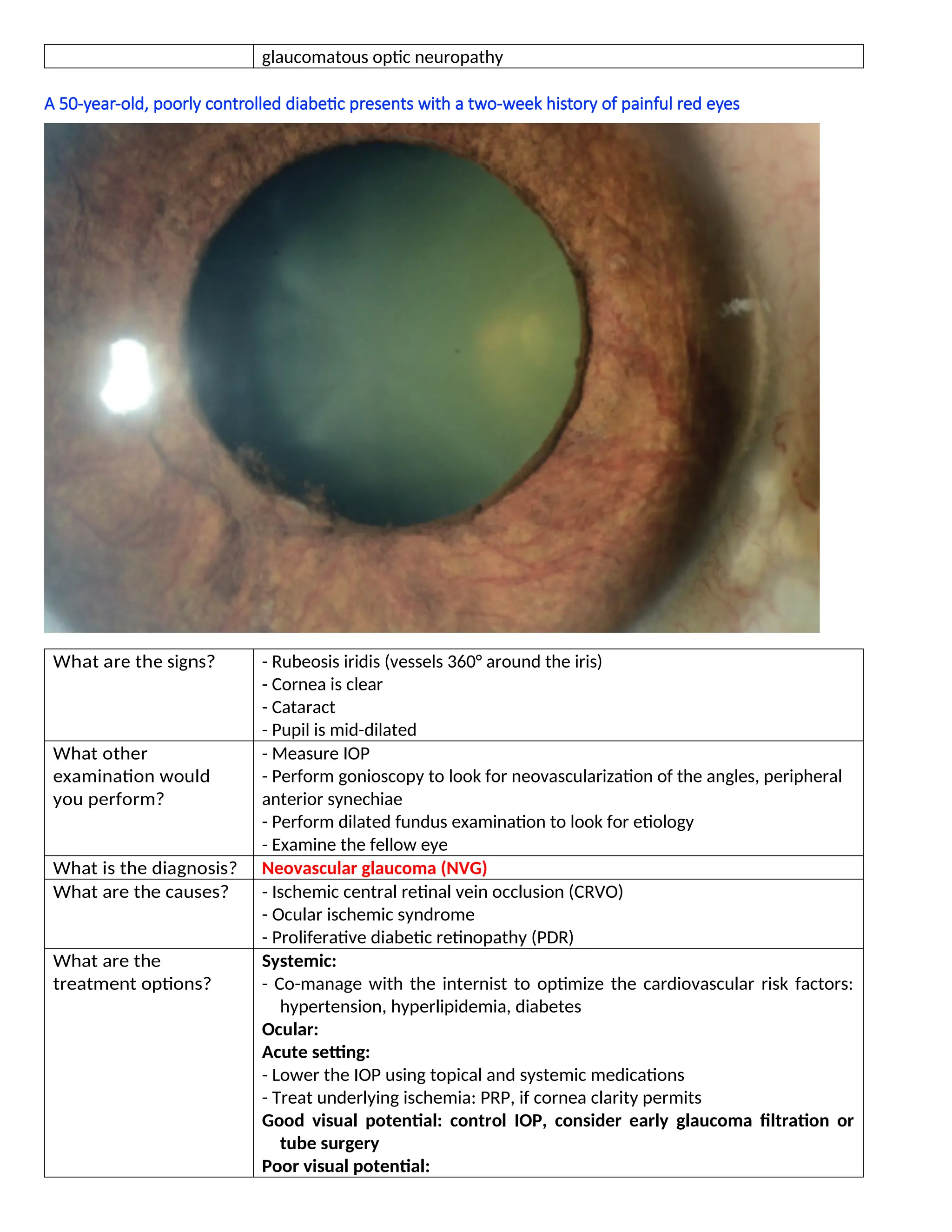 9 OSCE (Objective Structured Clinical Examination) Glaucoma.docx
