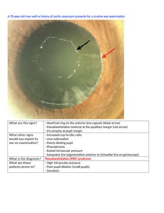 9 OSCE (Objective Structured Clinical Examination) Glaucoma.docx