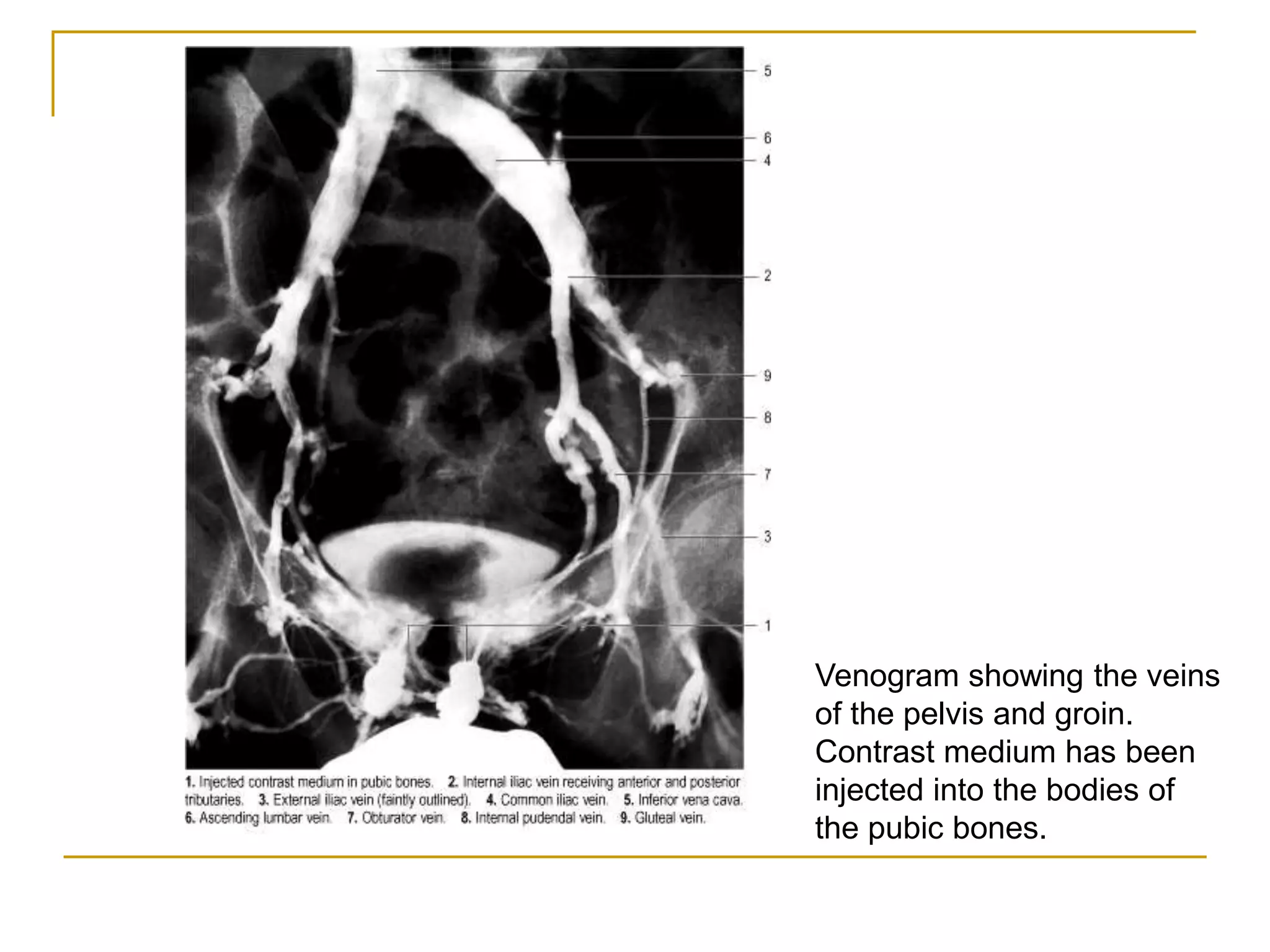 9 pelvic | PPT