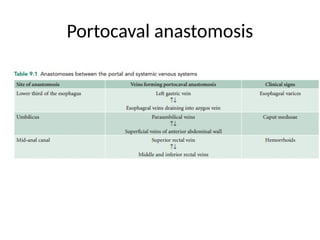 9 Portal-vein-an-portocaval-anastomosis.pptx