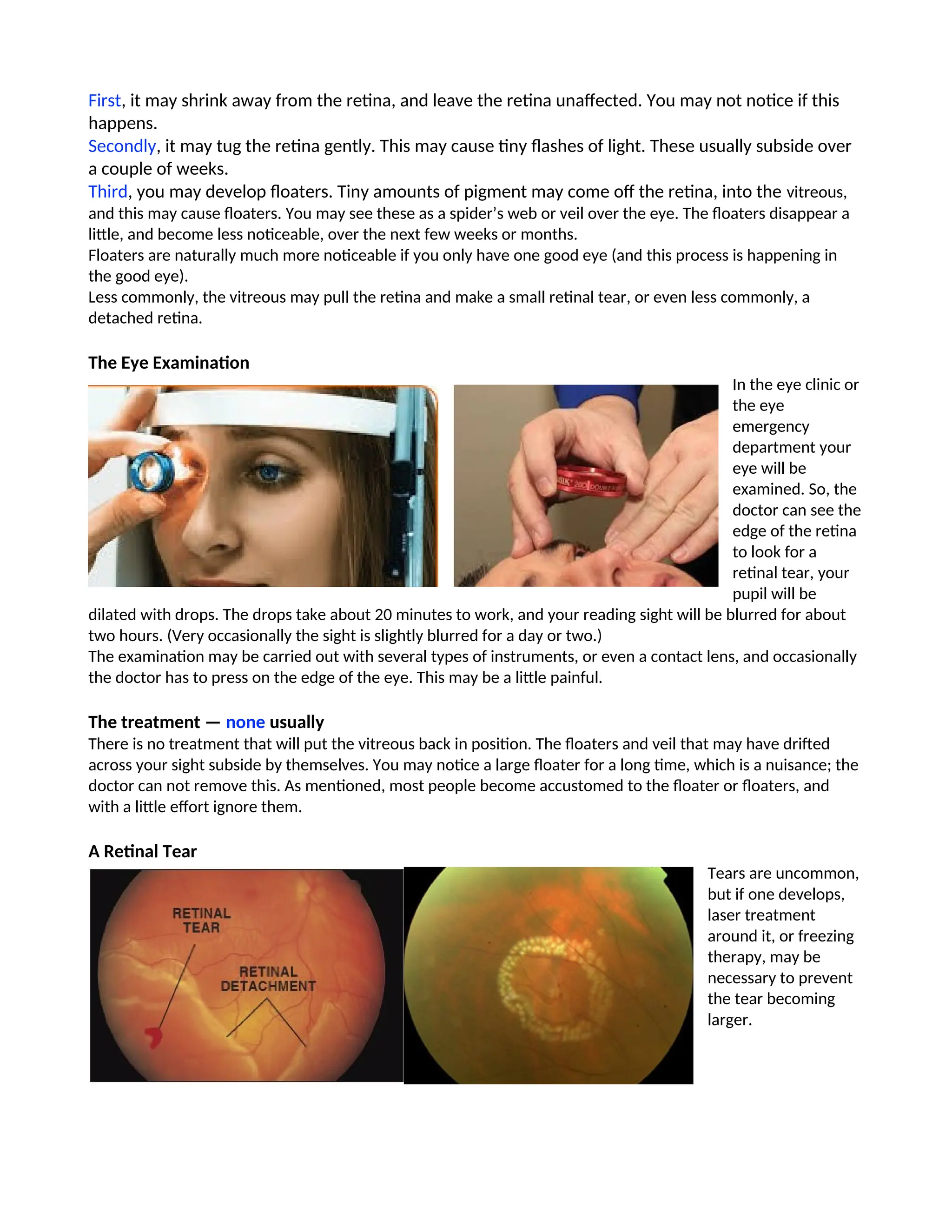 9Posterior Vitreous Detachment patient education | DOCX