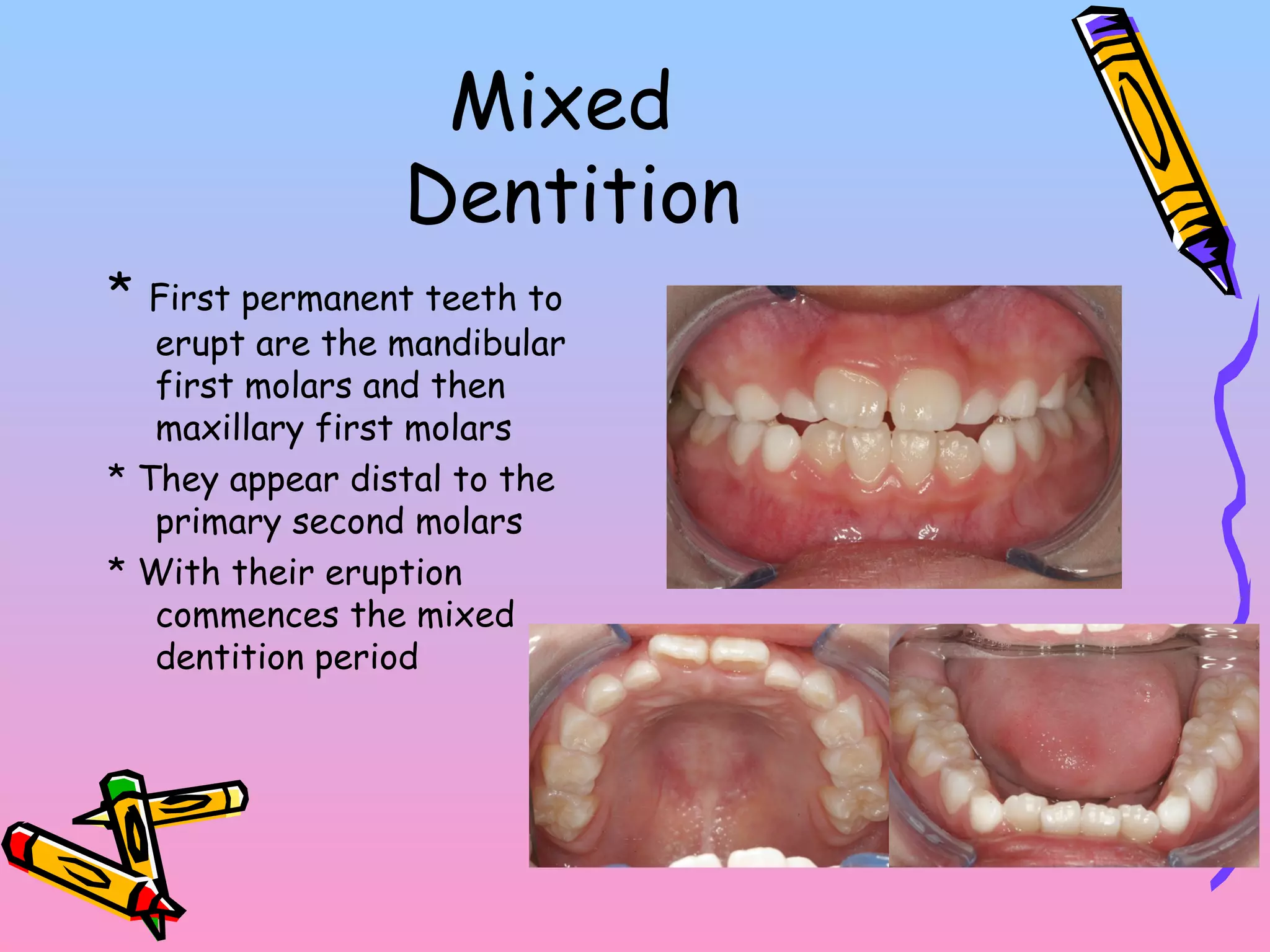 Primary Dentition and Eruption | PPT