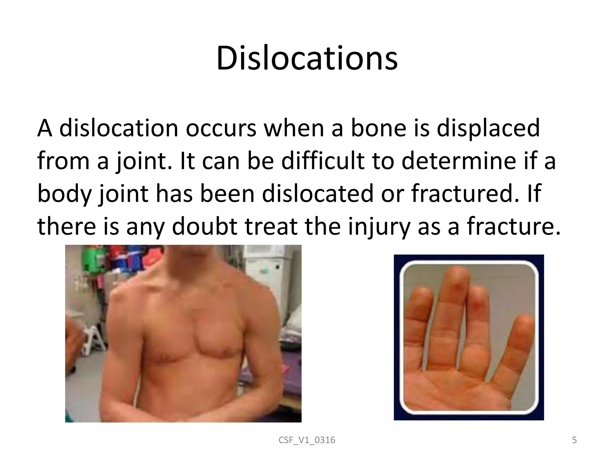 9 provide frist aid fractures and soft tissue injuries | PPTX