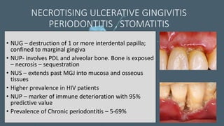 ROLE OF VIRUSES IN PERIODONTAL DISEASES | PPTX